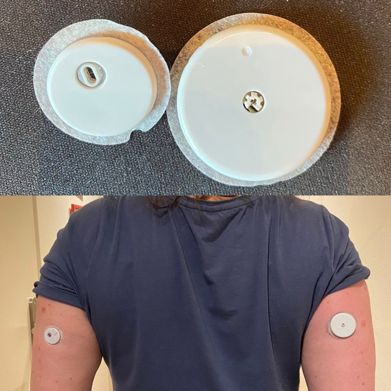 Erste Erfahrungen mit dem Freestyle Libre 3: Darf’s ein bisschen ...